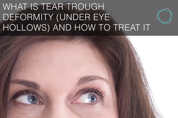 What is tear trough deformity (under eye hollows) and how to treat it